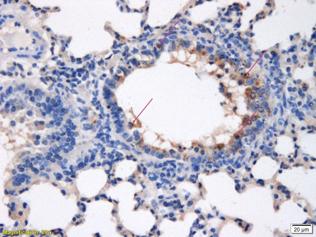 Calibration of IHC for Covid-19 virus - pathologica
